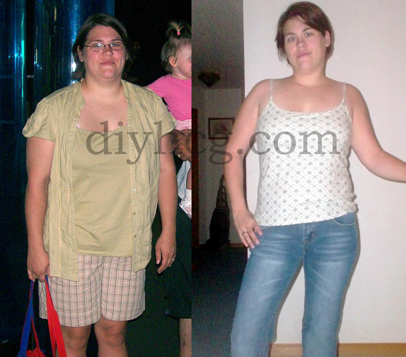 HCG Success Story Pictures & Diet Review - Heidi S - Do-It-Yourself HCG